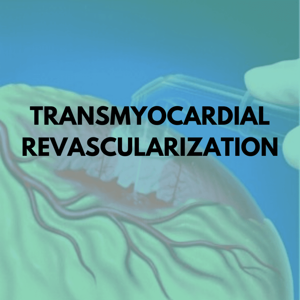 Transmyocardial Revascularization - Niruja HealthTech