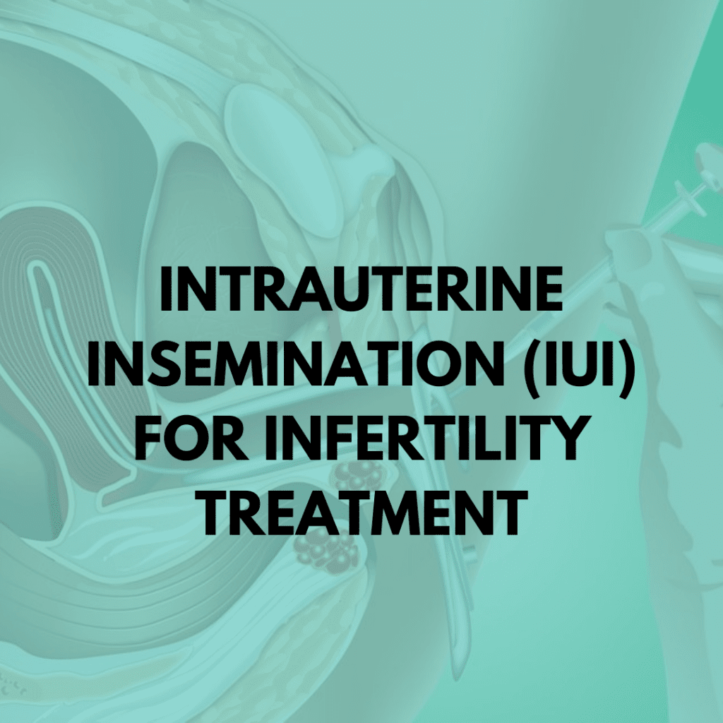 Intrauterine Insemination (IUI) for Infertility Treatment