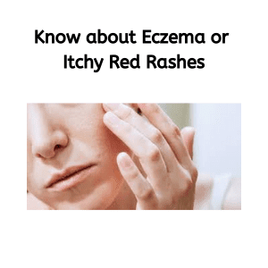 Know about Eczema or itchy red rashes - Niruja HealthTech