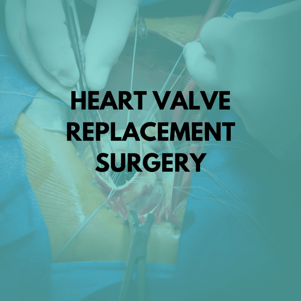 Heart Valve Surgery: Why is it performed?