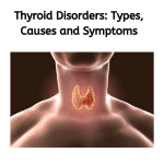 Thyroid Disorders: Types, Causes and Symptoms