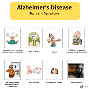 Alzheimer's Disease Infographic: Signs & Symptoms