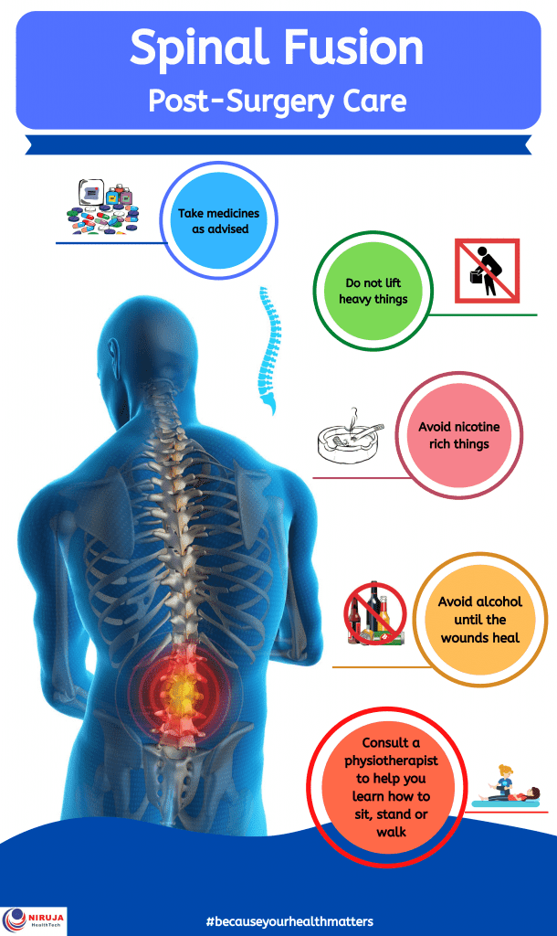 Spinal Fusion Post Surgery Care Spinal Fusion Post Surgery Care