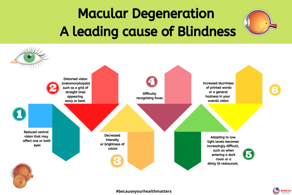 Macular Degeneration A Leading Cause Of Blindness Niruja HealthTech Macular Degeneration A Leading Cause Of Blindness Niruja HealthTech