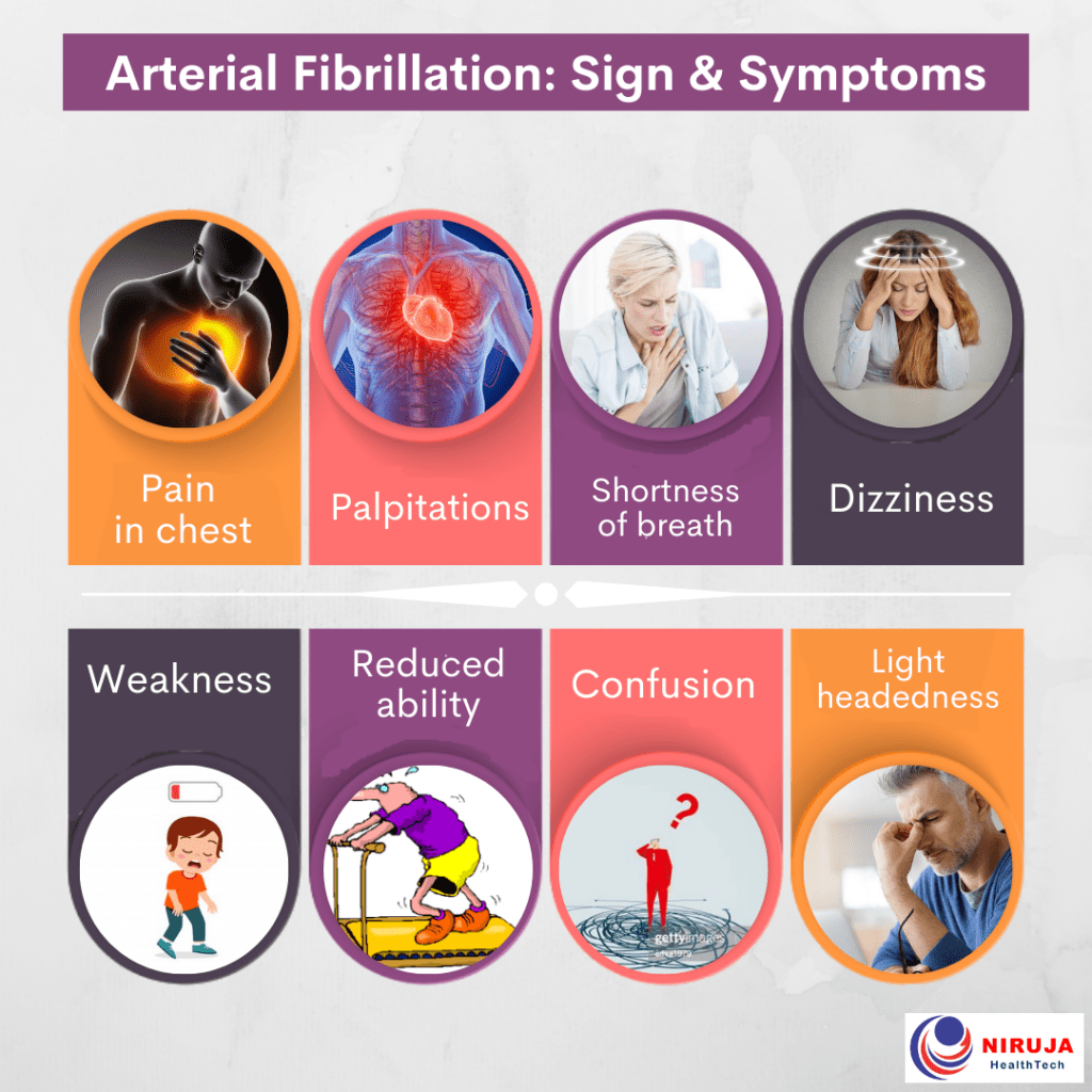 Arterial Fibrillation: Sign & Symptoms