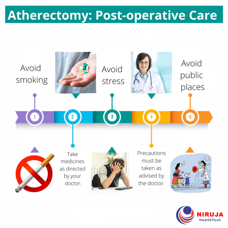 Atherectomy: A Relief for Clogged Arteries
